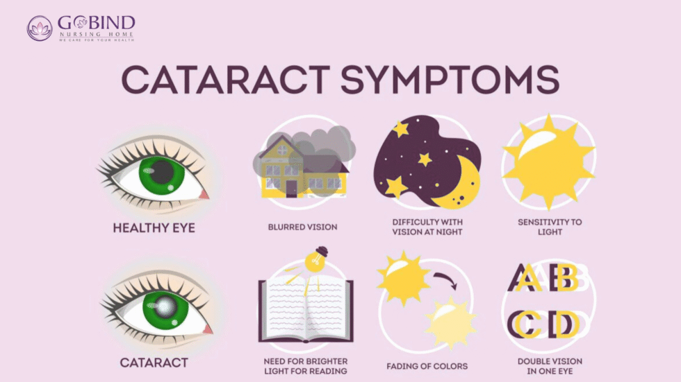 What Is Phacoemulsification? A Complete Guide - Cataract Surgery