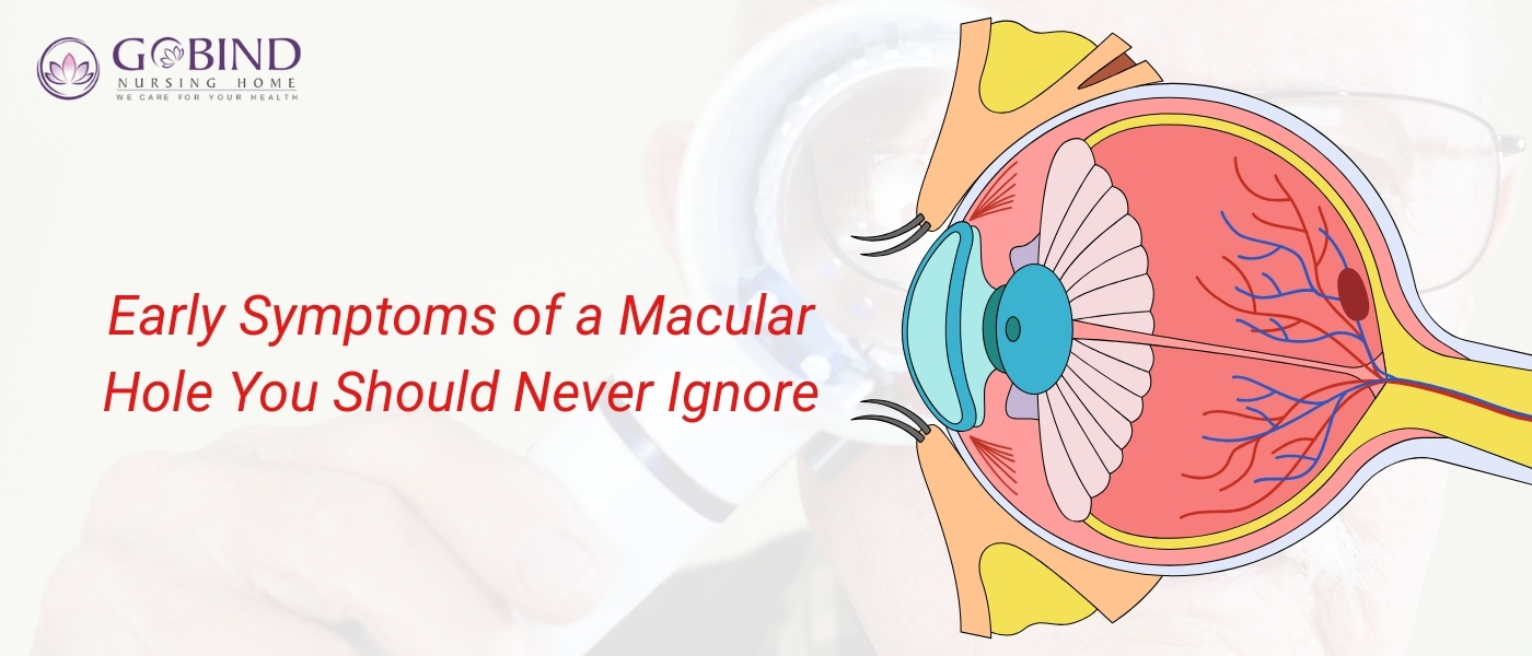 Early Symptoms of a Macular Hole You Should Never Ignore - Gobind ...